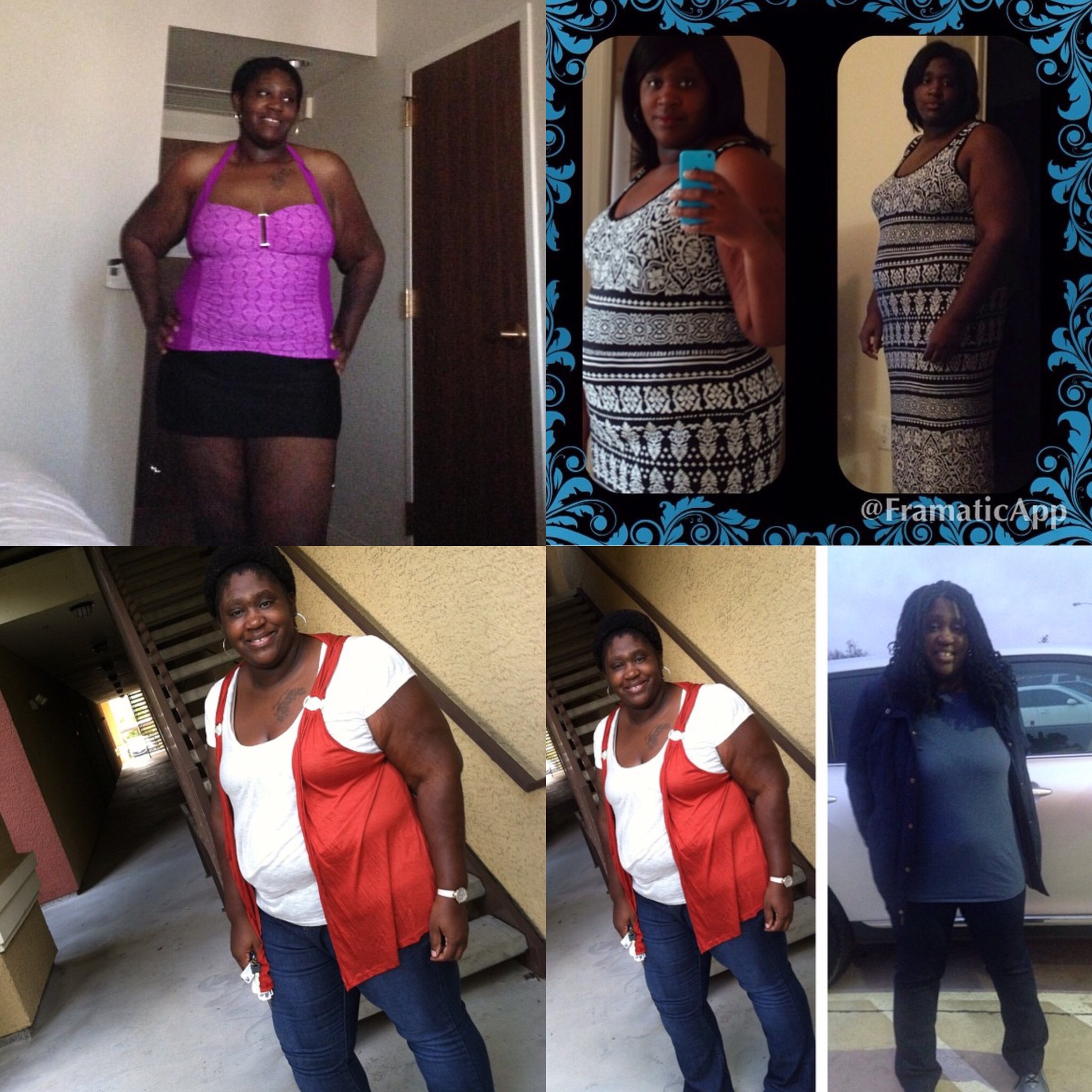 360 Bariatrics: Re-Shaping Bodies & Lives | The Complete Bariatric ...